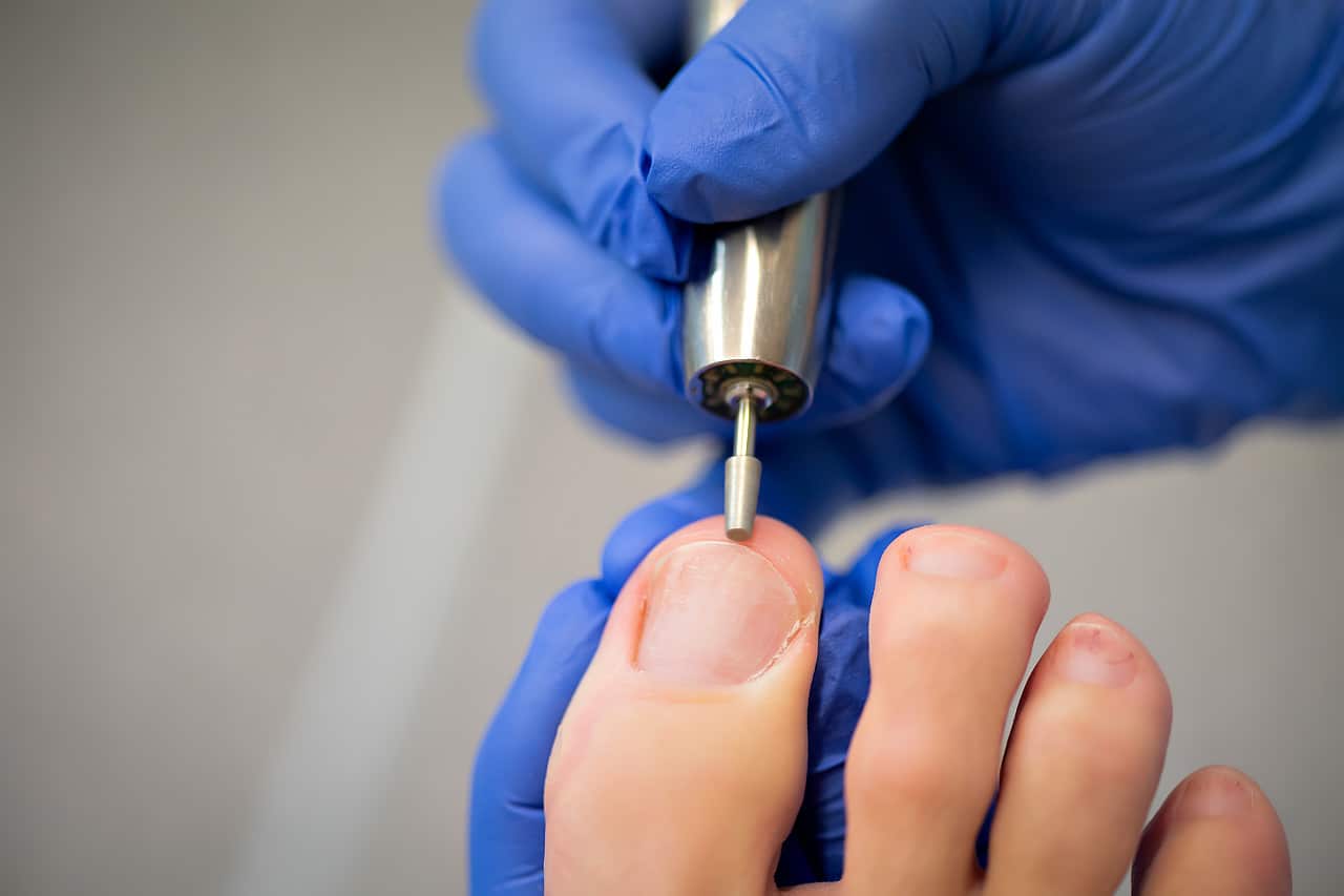 Fodbehandlinger hos Statsautoriseret Fodterapeut