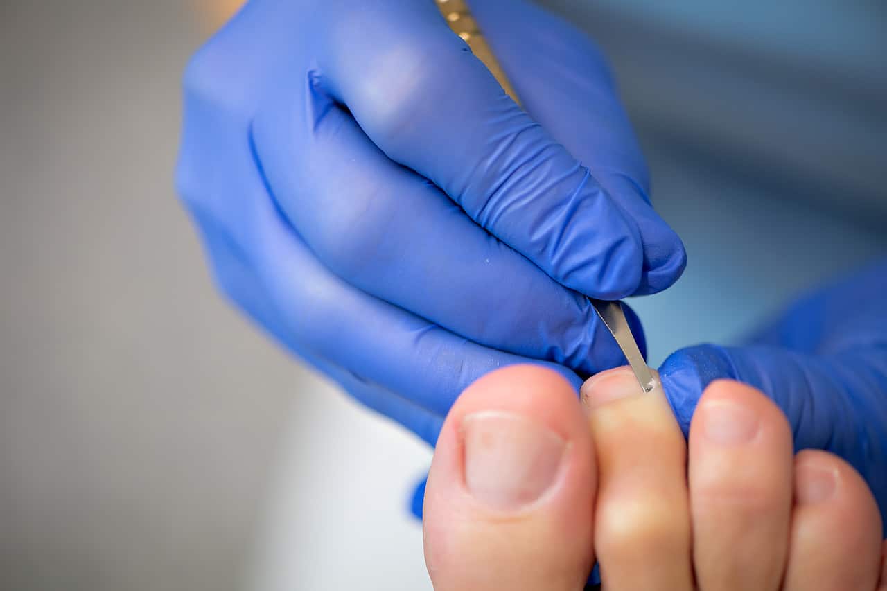 Fodbehandlinger hos Statsautoriseret Fodterapeut