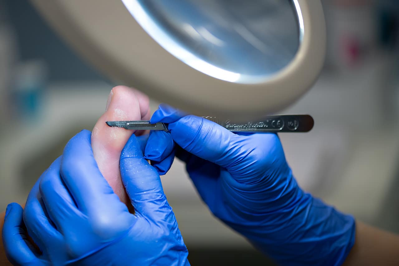 Fodbehandlinger hos Statsautoriseret Fodterapeut